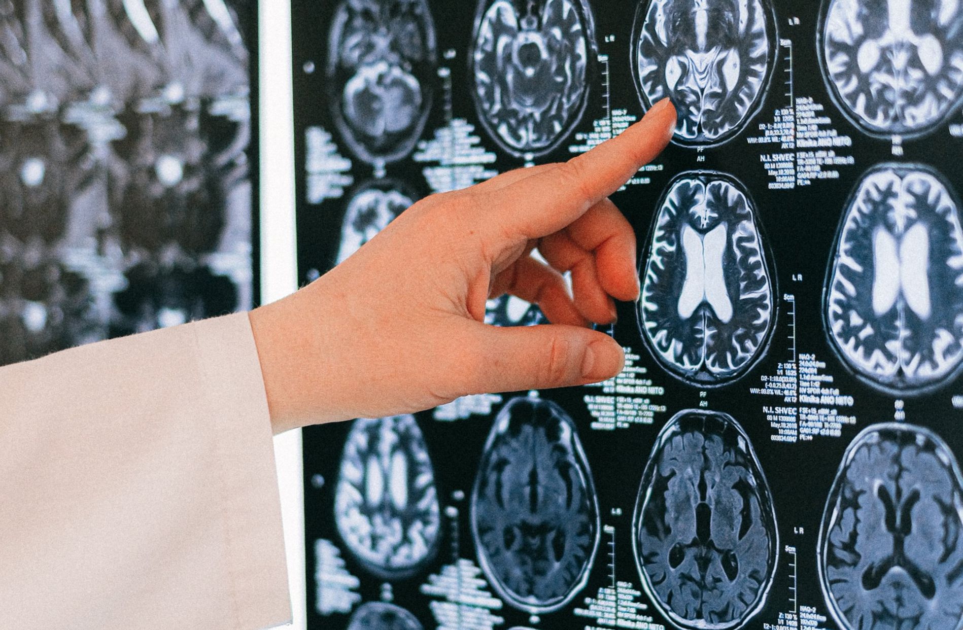Fox Valley Imaging, RT 59 Naperville 630-416-1300, MRI, CT ...