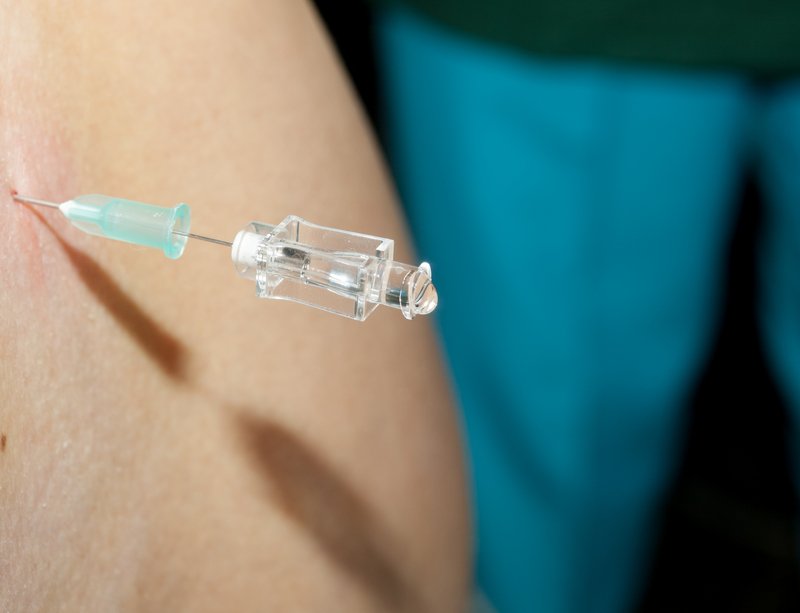 Skull Base Surgery and Brain Fluid Leak Repair - Eric Succar, MD ...