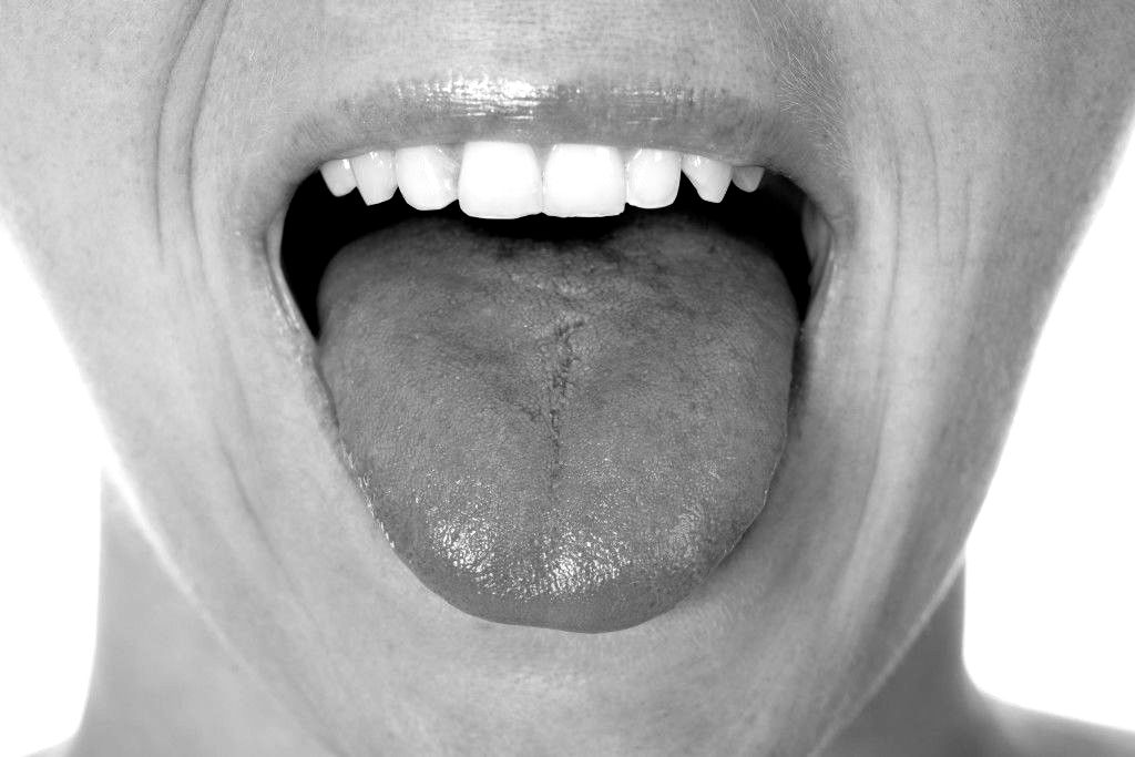 Myofunctional Therapy | Evansville, Indiana | Functional Face OMT