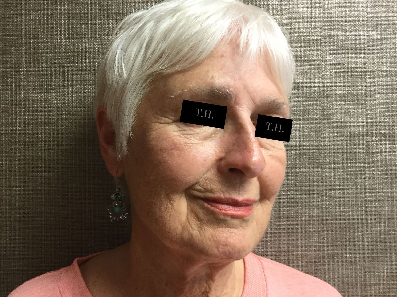 Gallery | Thomas Hocker MD