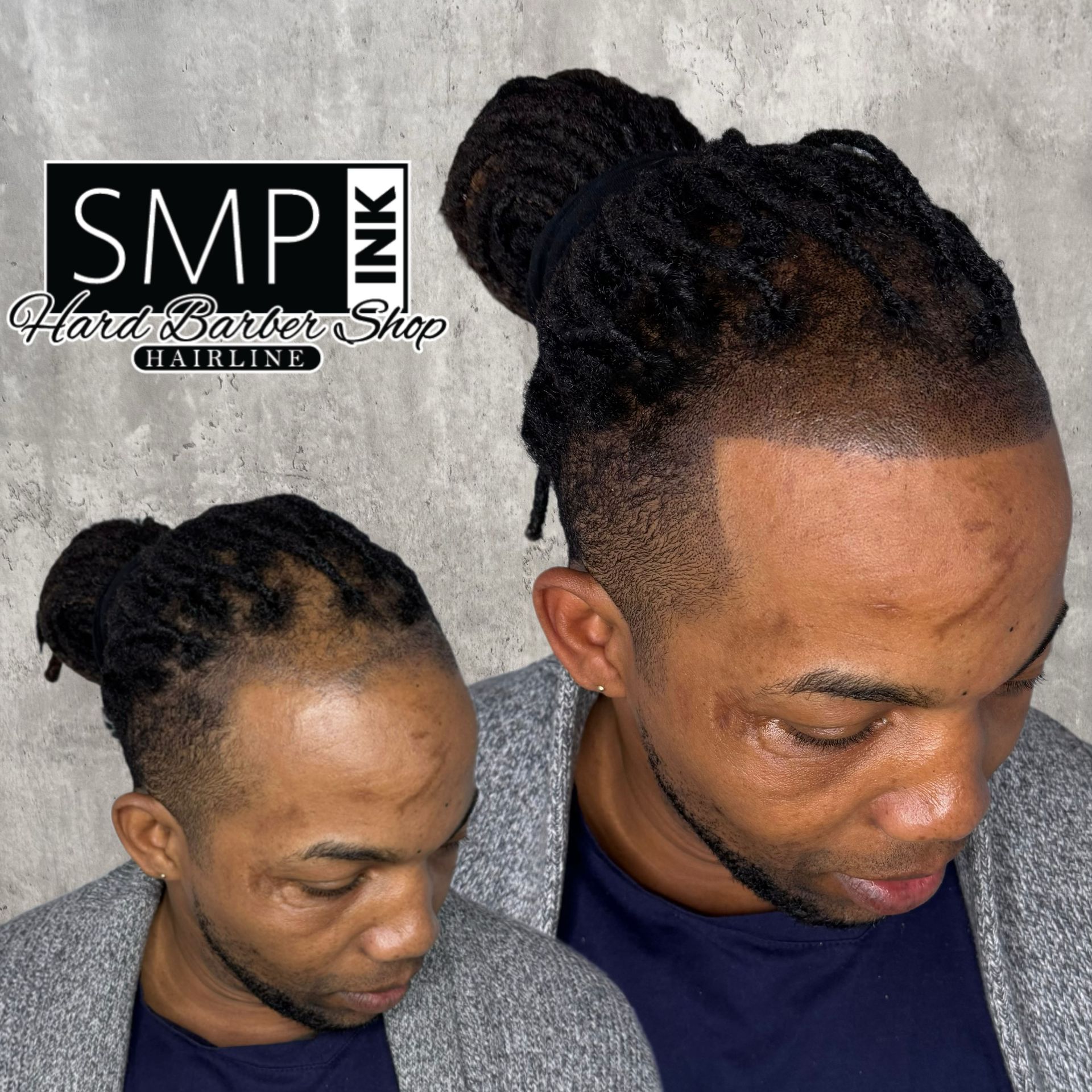 Scalp Micropigmentation | SMP INK | Las Vegas
