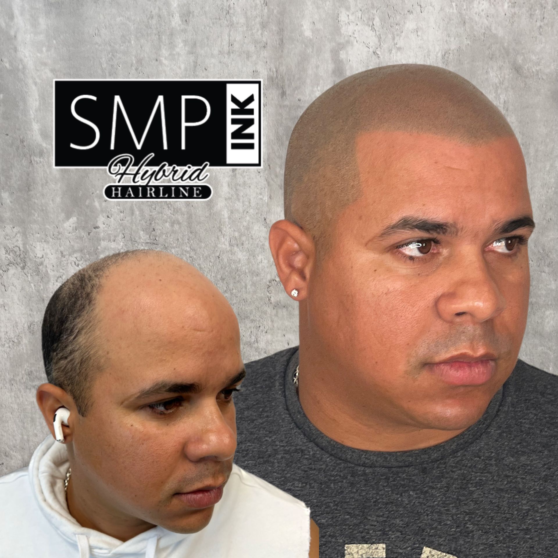 Scalp Micropigmentation | SMP INK | Las Vegas