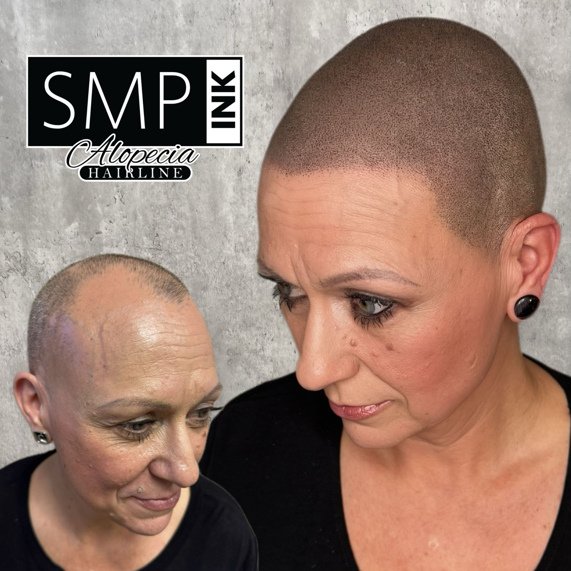 Scalp Micropigmentation | SMP INK | Las Vegas