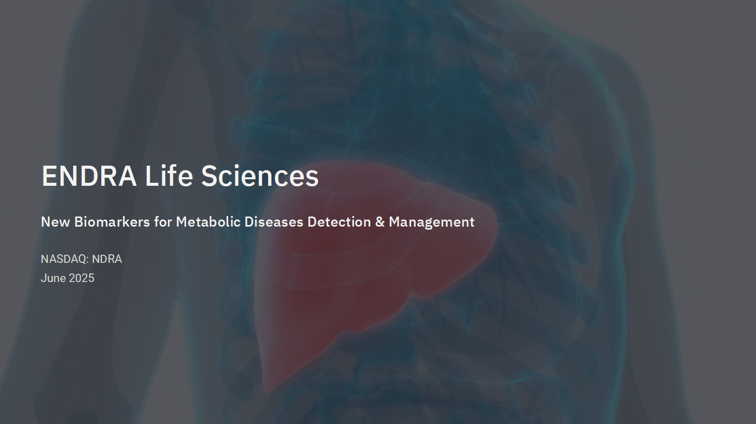 Investor Relations - Endra