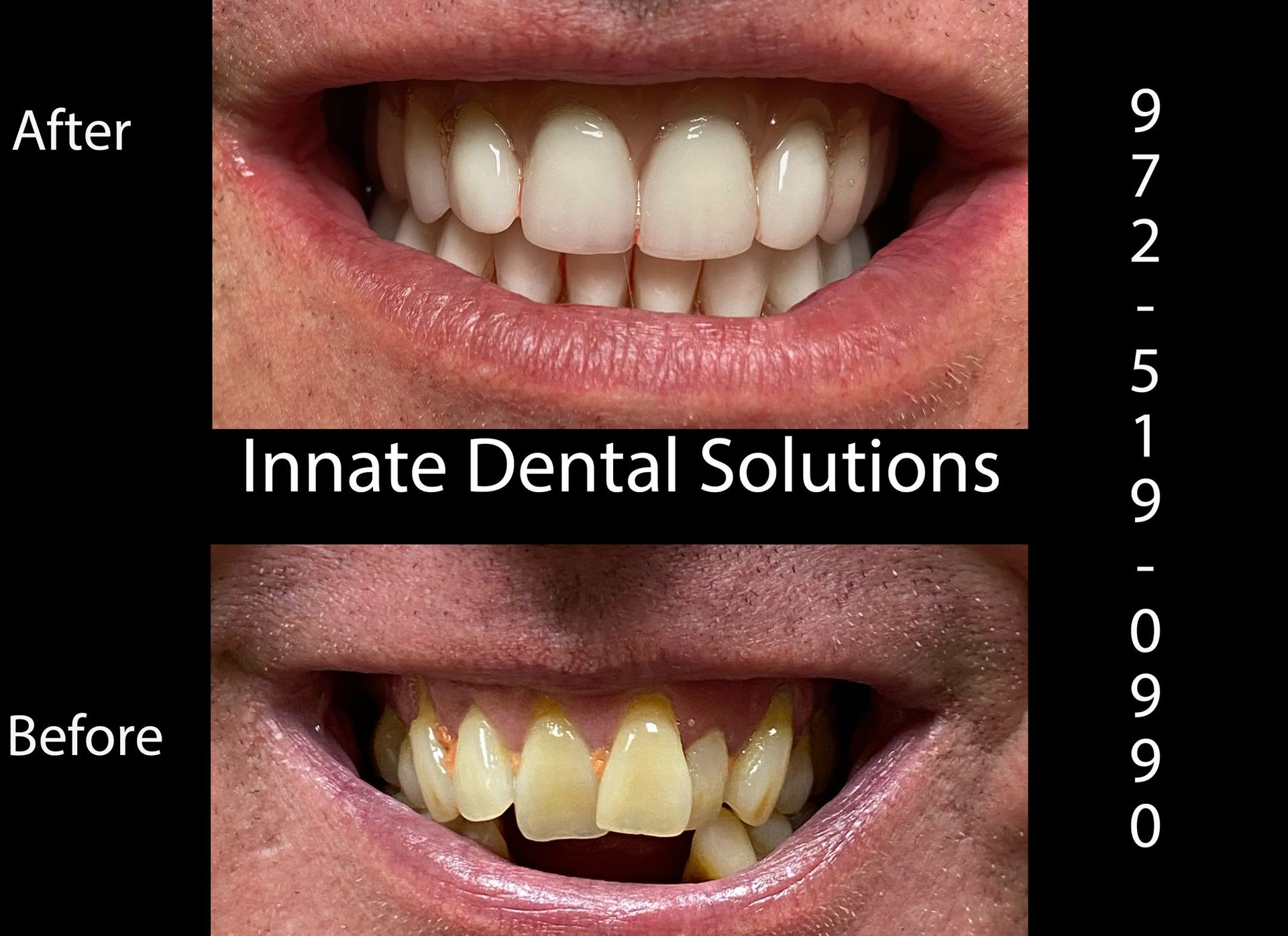 Innate Dental Solutions | Waxahachie, TX