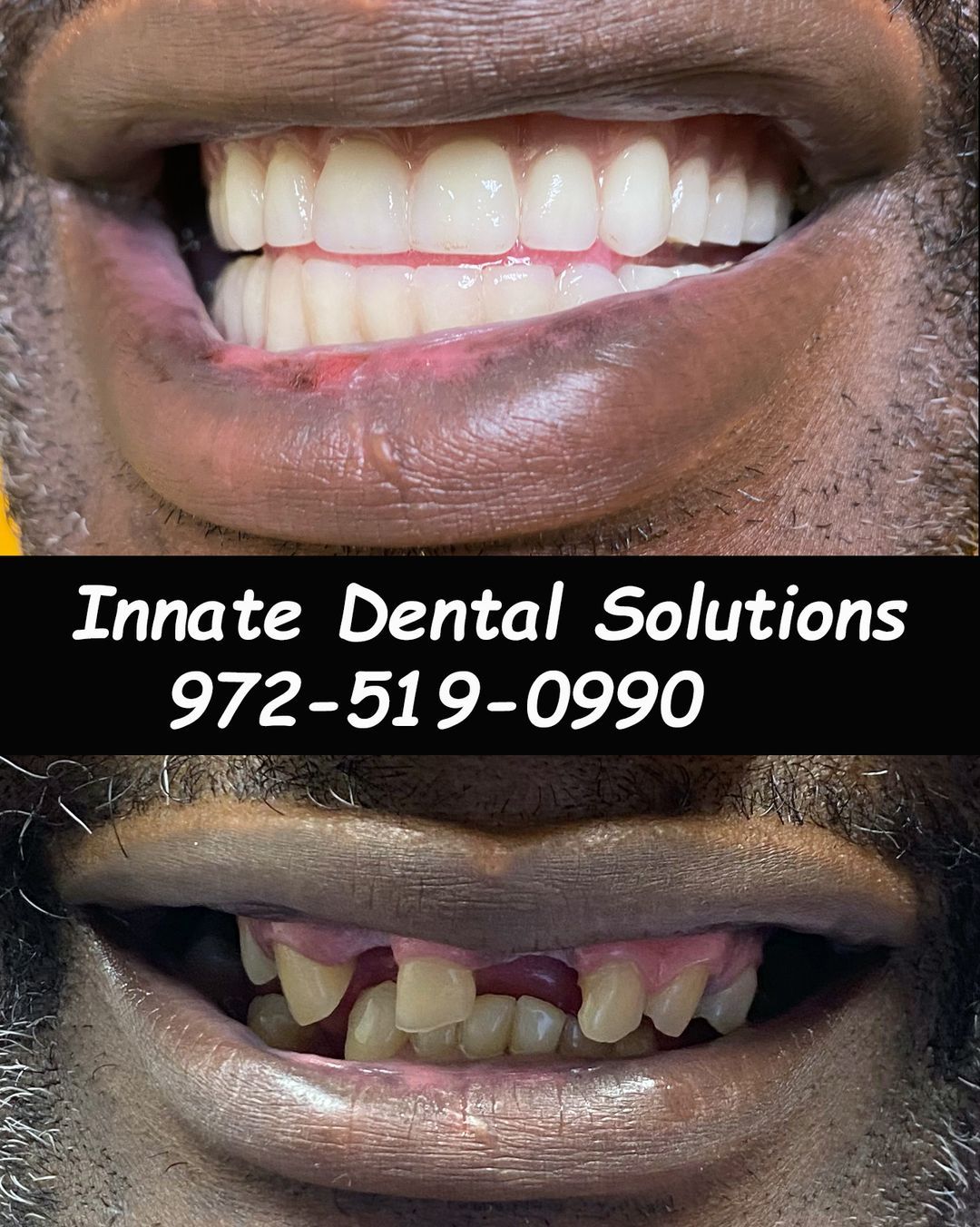 Innate Dental Solutions | Waxahachie, TX