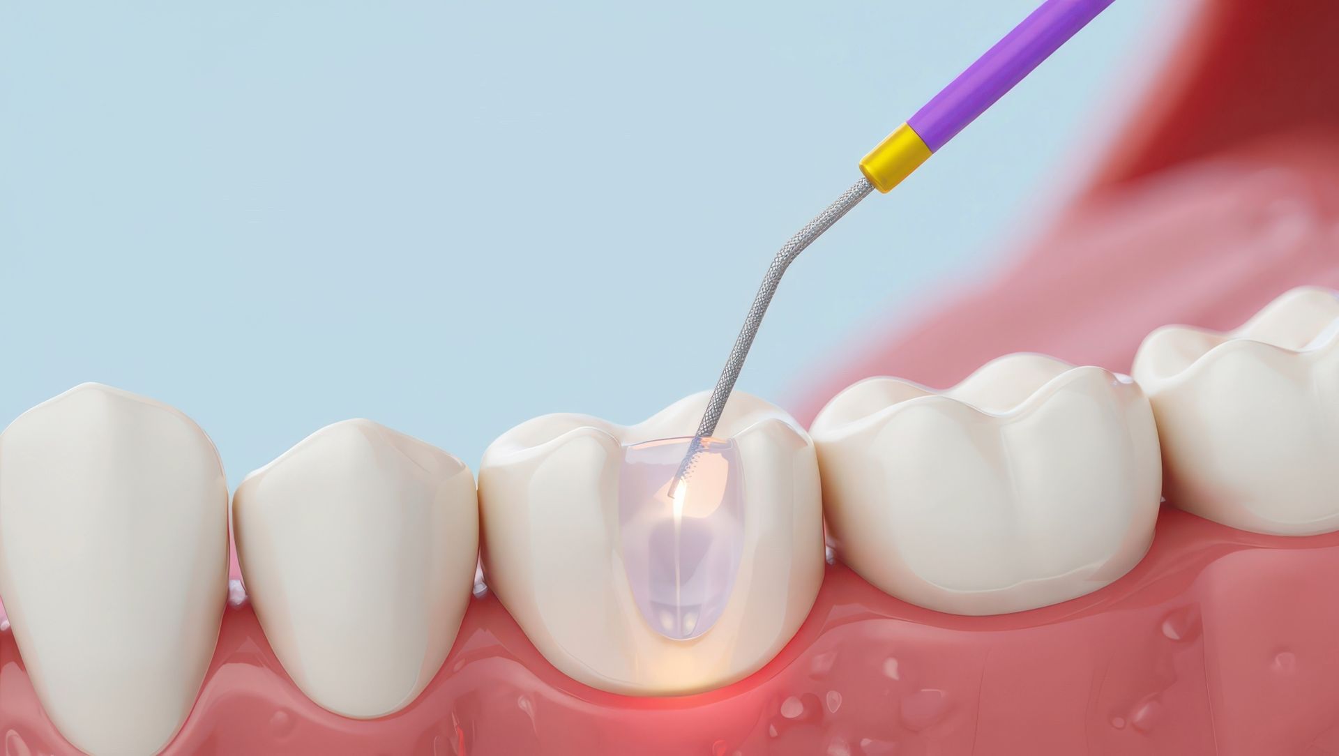 Cosmetic Fillings in Brandon & Tampa, FL | Endothetics