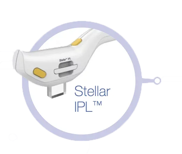 Lumenis M22 Treatment Leeds & Cheshire | Aesthetica Medical