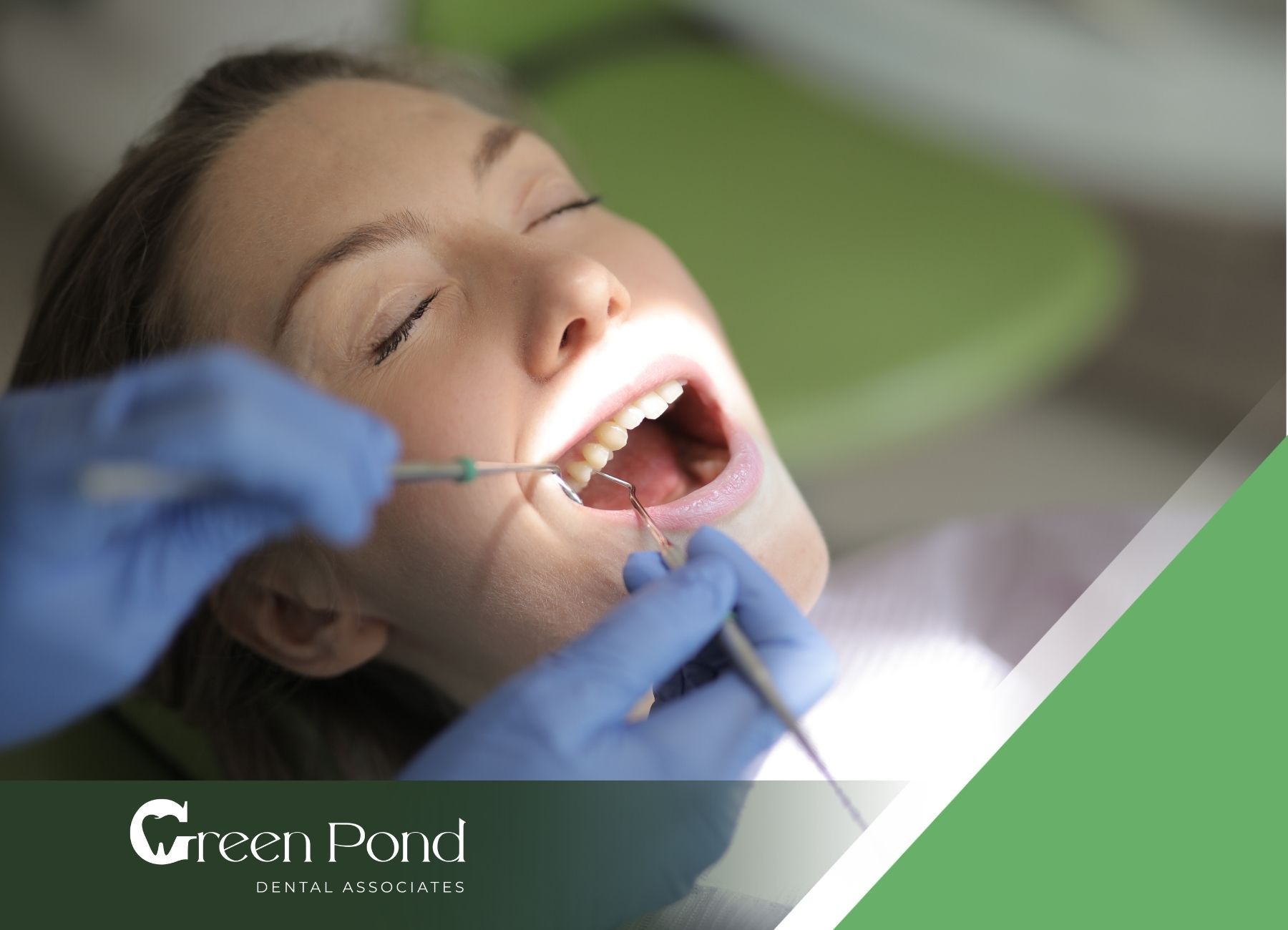 Normal Socket After Tooth Extraction Healed Or Fresh Extraction Socket