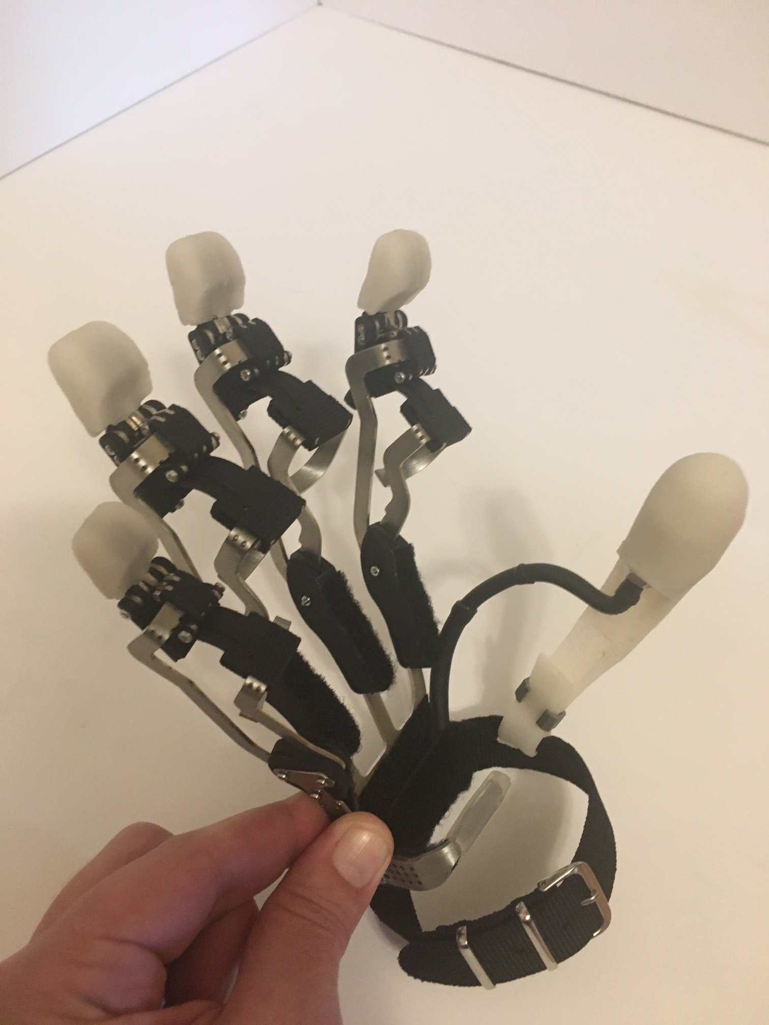 Body-Powered Prosthetic Fingers | Bowman Medical International