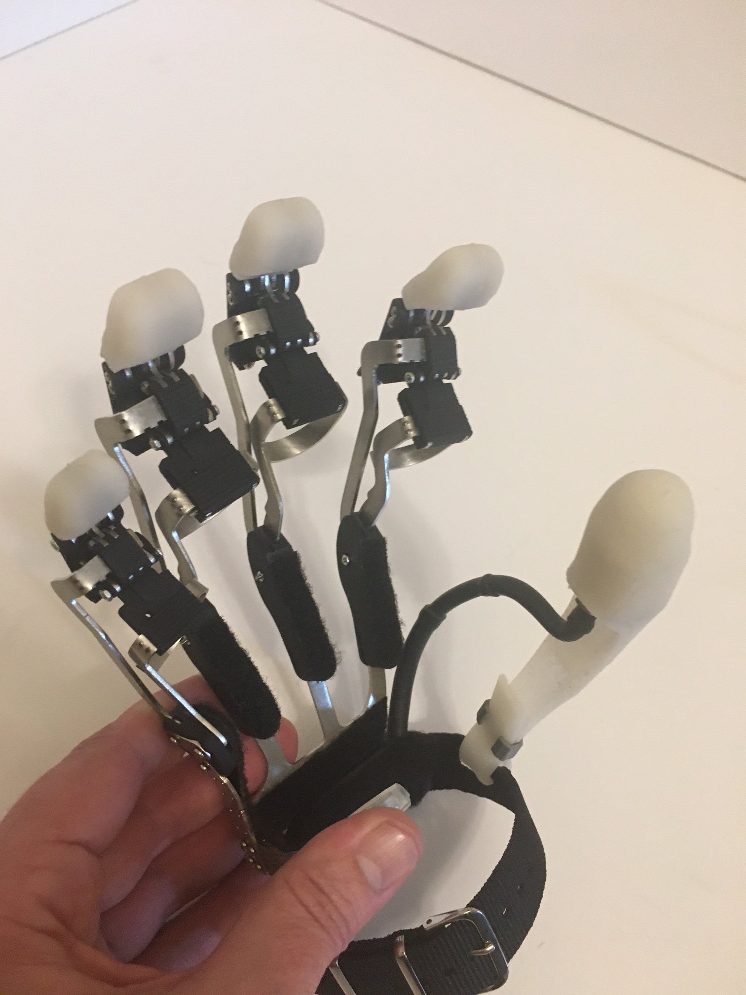 Body-Powered Prosthetic Fingers | Bowman Medical International