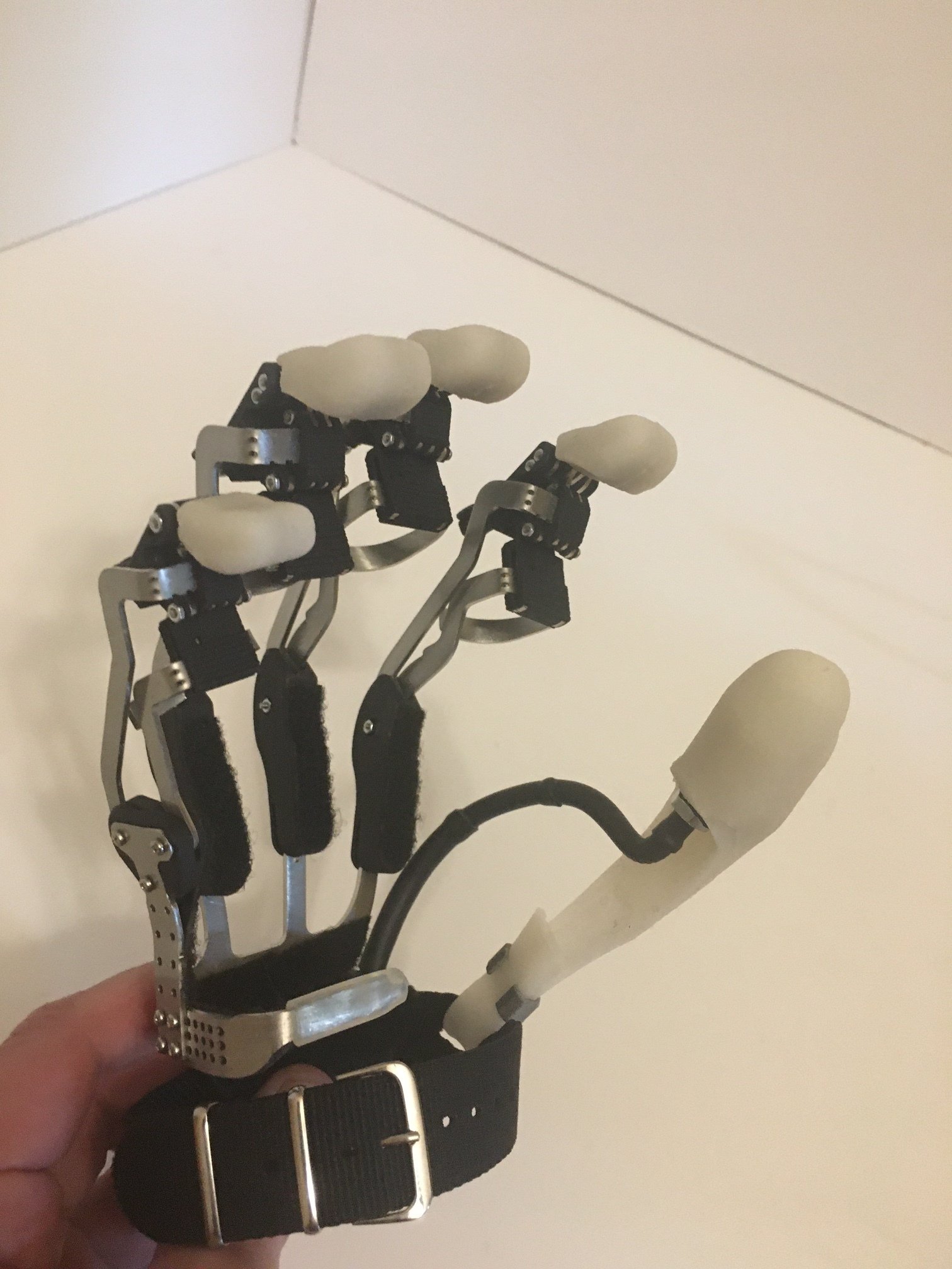 Body-Powered Prosthetic Fingers | Bowman Medical International