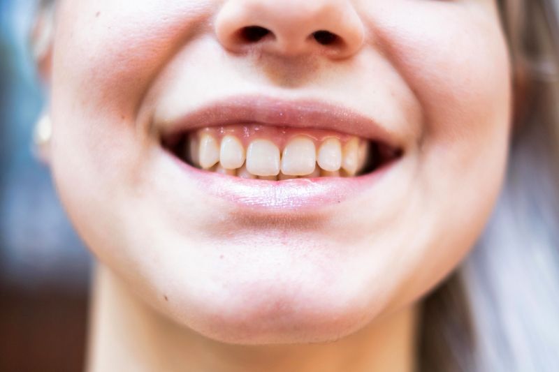 Dental Care | Ventura, CA | Surfside Dental