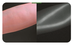 Hamamatsu PDE®-GEN3 Handheld ICG Imaging System