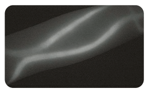 Hamamatsu PDE®-GEN3 Handheld ICG Imaging System