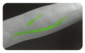 Hamamatsu PDE®-GEN3 Handheld ICG Imaging System