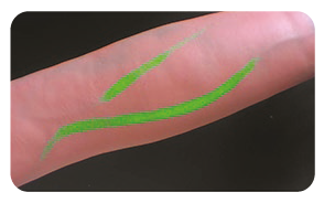 Hamamatsu PDE®-GEN3 Handheld ICG Imaging System