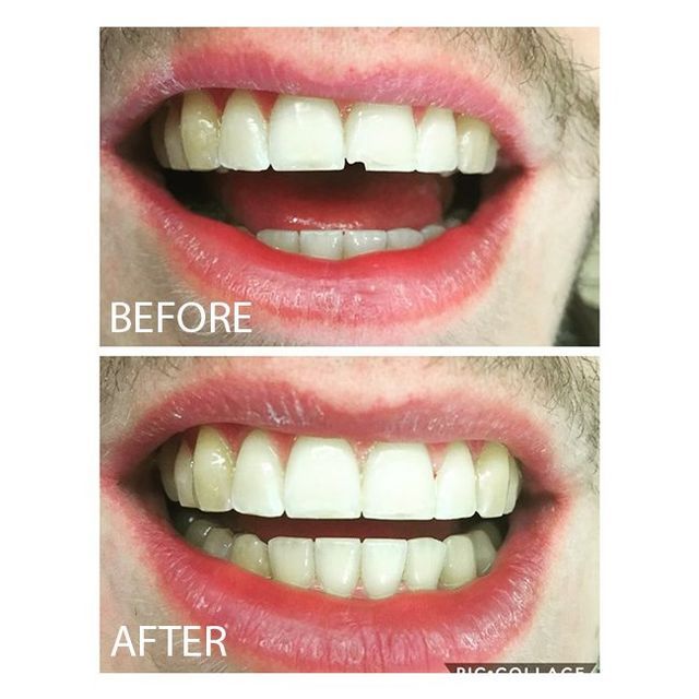 Smile Gallery Steliotes Dental Spa - McMurray PA