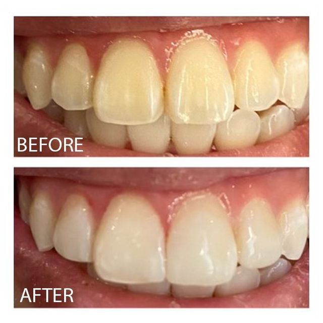 Smile Gallery Steliotes Dental Spa - McMurray PA