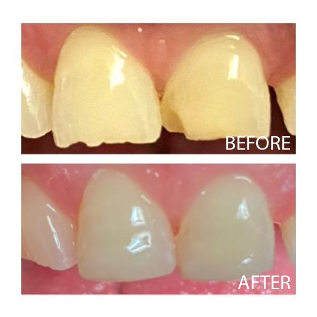 Smile Gallery Steliotes Dental Spa - McMurray PA