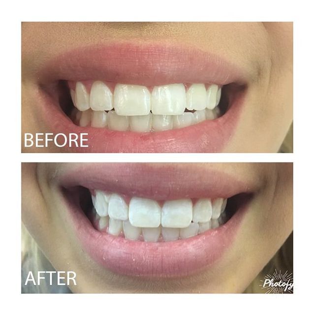 Smile Gallery Steliotes Dental Spa - McMurray PA