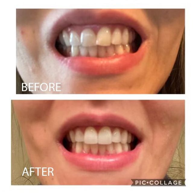 Smile Gallery Steliotes Dental Spa - McMurray PA