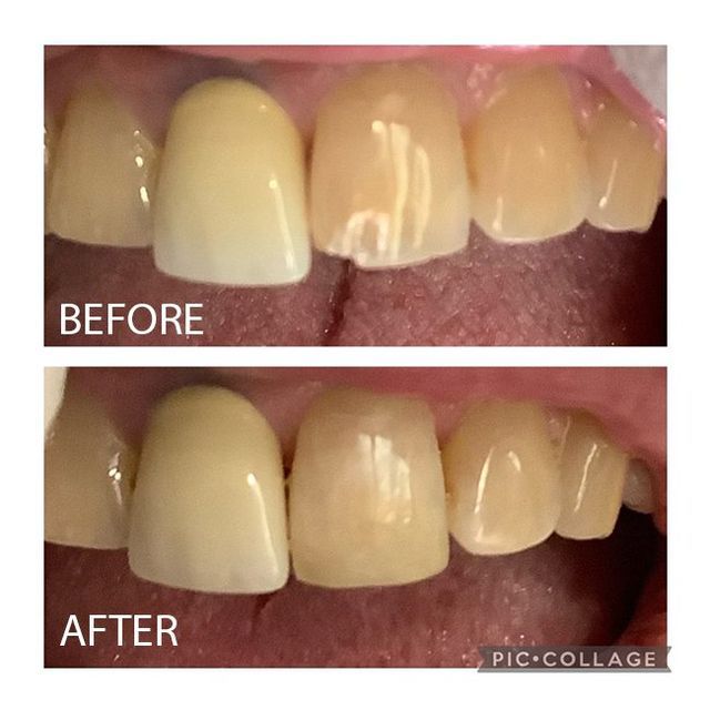 Smile Gallery Steliotes Dental Spa - McMurray PA