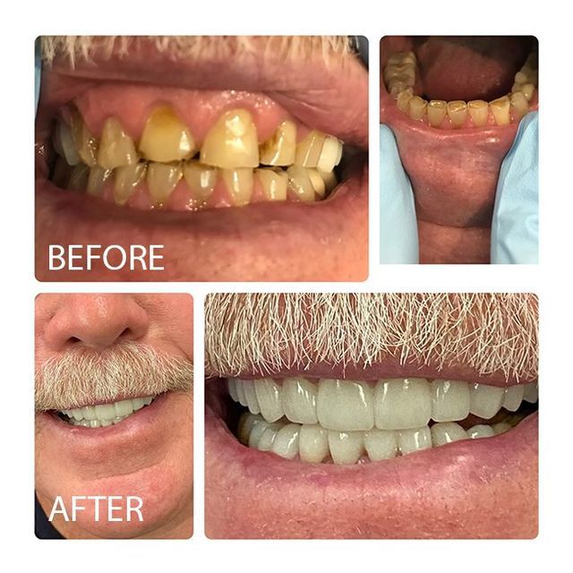 Smile Gallery Steliotes Dental Spa - McMurray PA