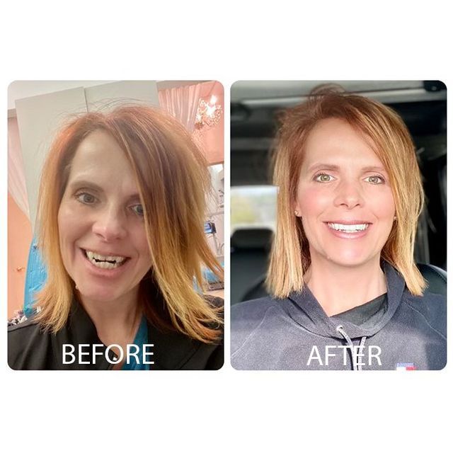 Smile Gallery Steliotes Dental Spa - McMurray PA
