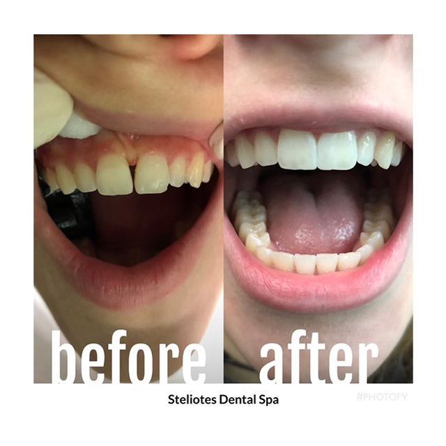 Smile Gallery Steliotes Dental Spa - McMurray PA