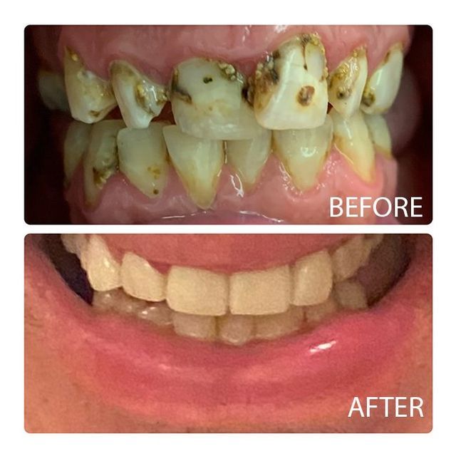 Smile Gallery Steliotes Dental Spa - McMurray PA