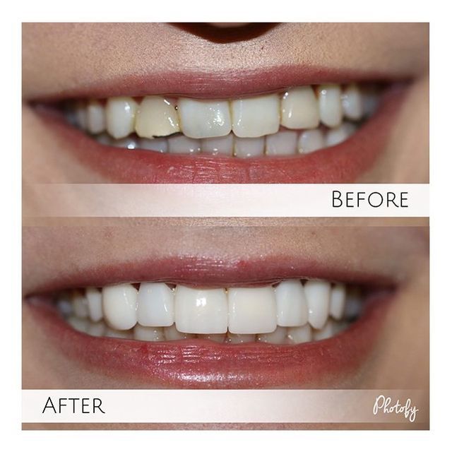 Smile Gallery Steliotes Dental Spa - McMurray PA