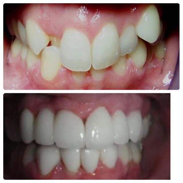 Smile Gallery Steliotes Dental Spa - McMurray PA