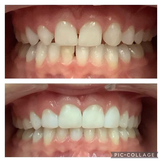 Smile Gallery Steliotes Dental Spa - McMurray PA