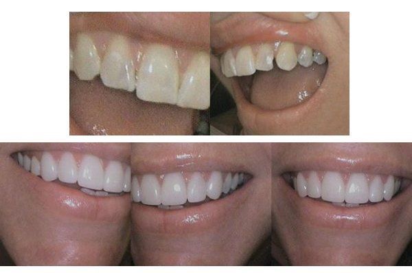 Smile Gallery Steliotes Dental Spa - McMurray PA