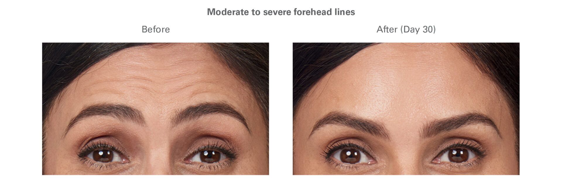 Medspa | Loveland, CO | Nu-Reflections Medspa