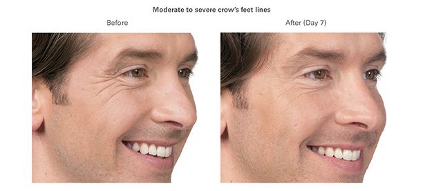 Medspa | Loveland, CO | Nu-Reflections Medspa