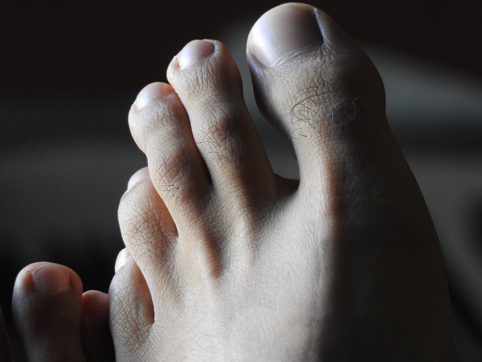 Foot Pain Relief | Foot Doctor-Podiatrist | Littleton, CO