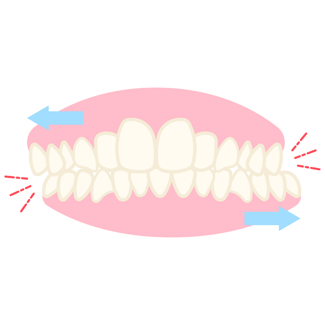 Common Orthodontic Problems | Dr. Bennion Orthodontics