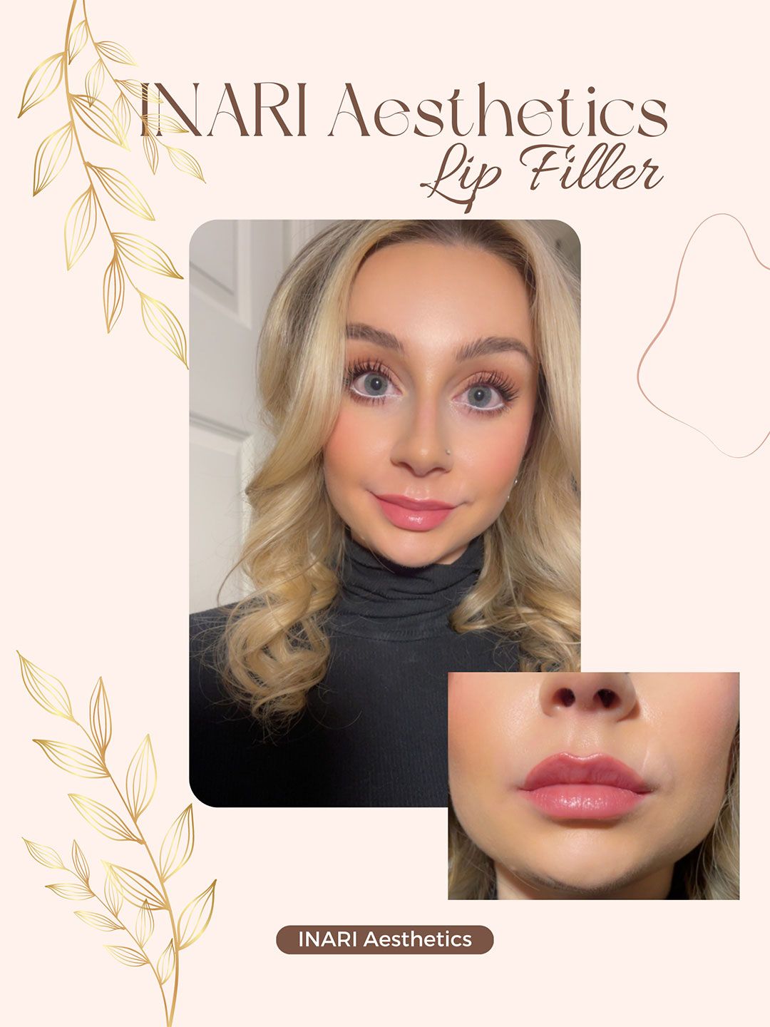 Gallery | INARI Aesthetics | Bennington, VT & Troy, NY