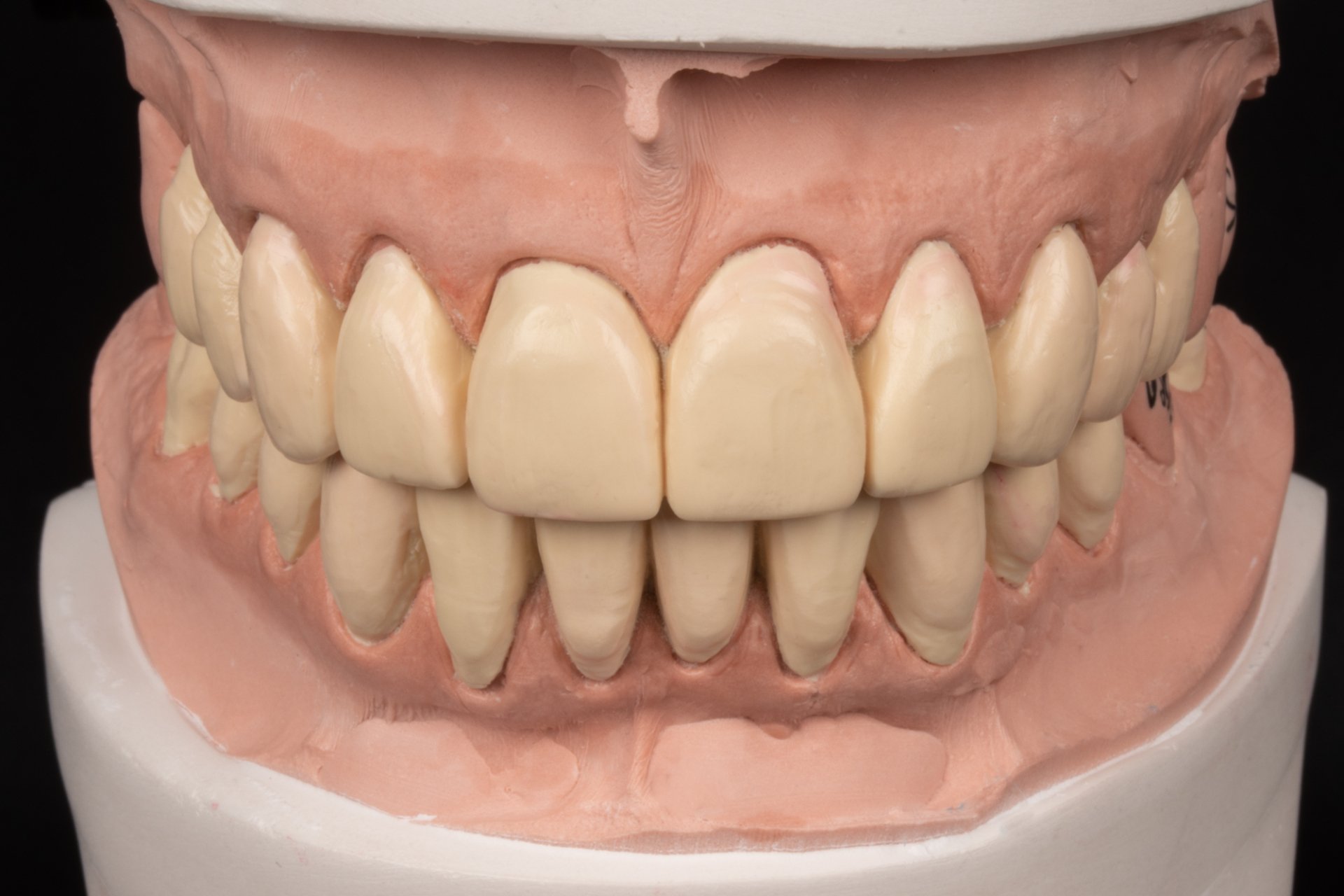 Bay View Dental Lab | Chesapeake, VA