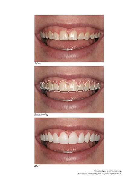 Bay View Dental Lab | Chesapeake, VA