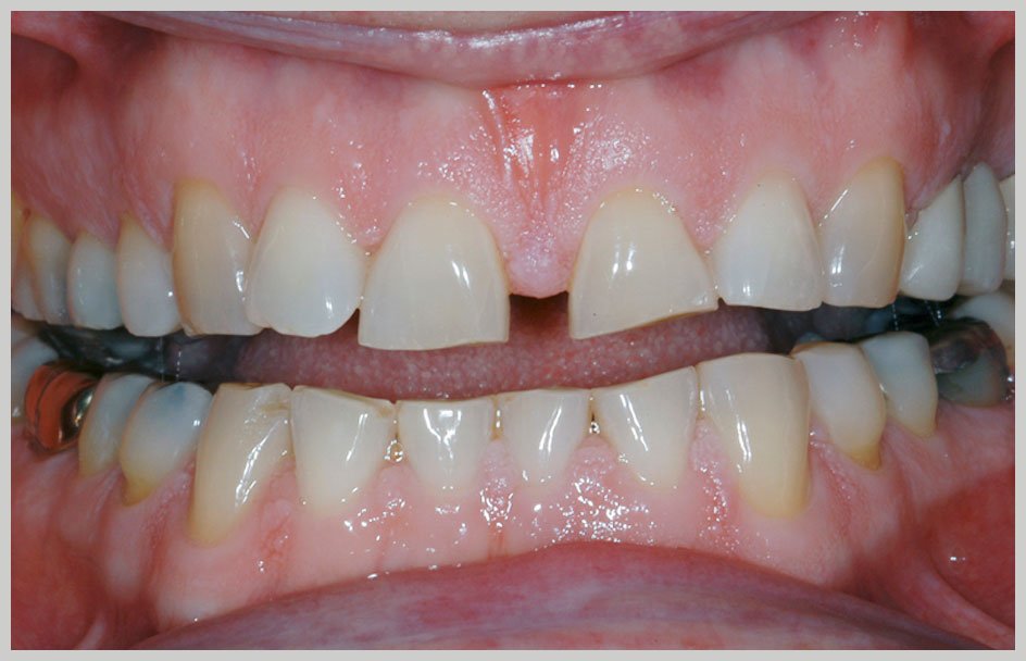 Bay View Dental Lab | Chesapeake, VA