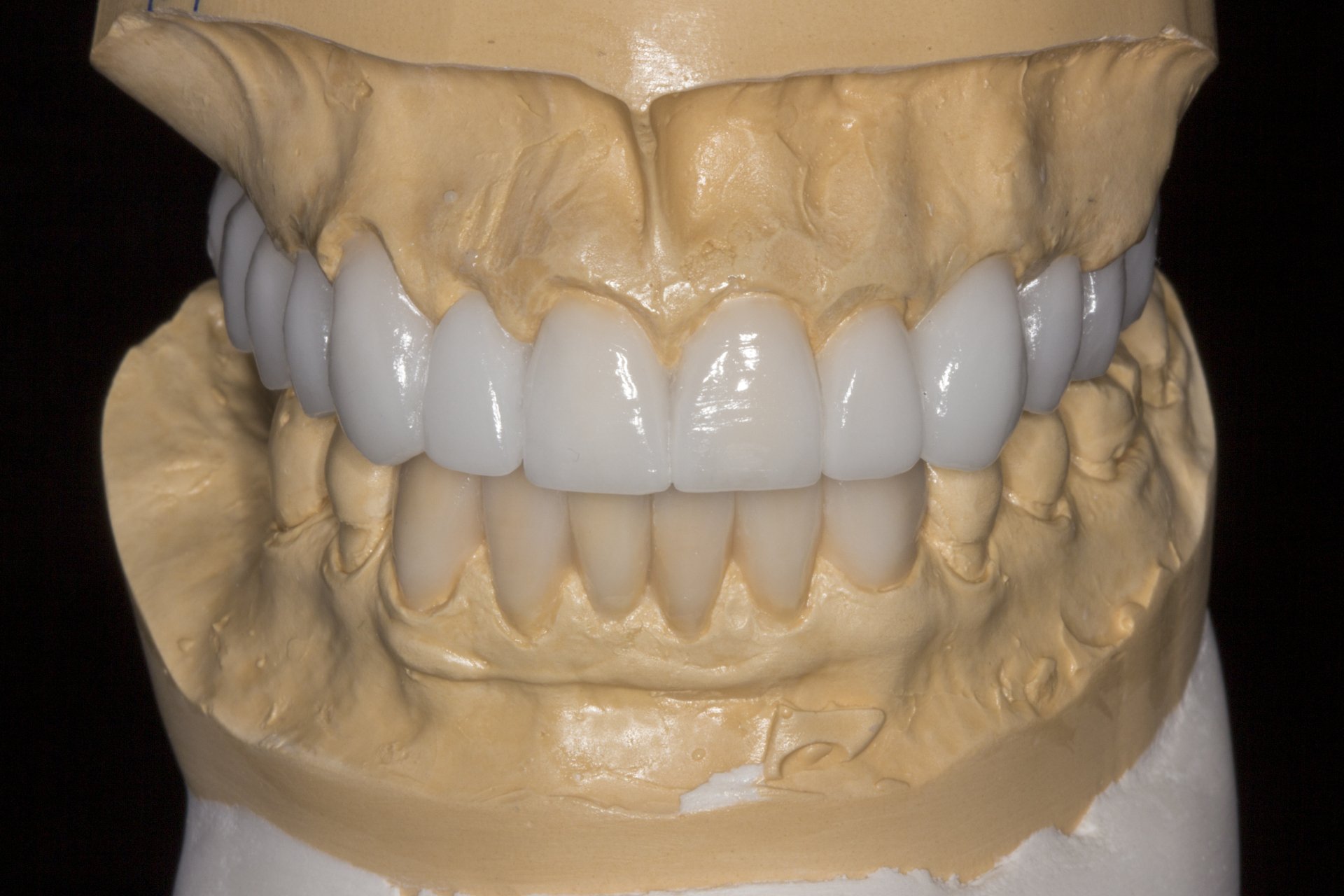 Bay View Dental Lab | Chesapeake, VA