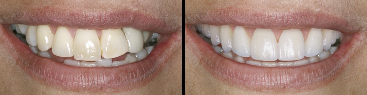 Bay View Dental Lab | Chesapeake, VA