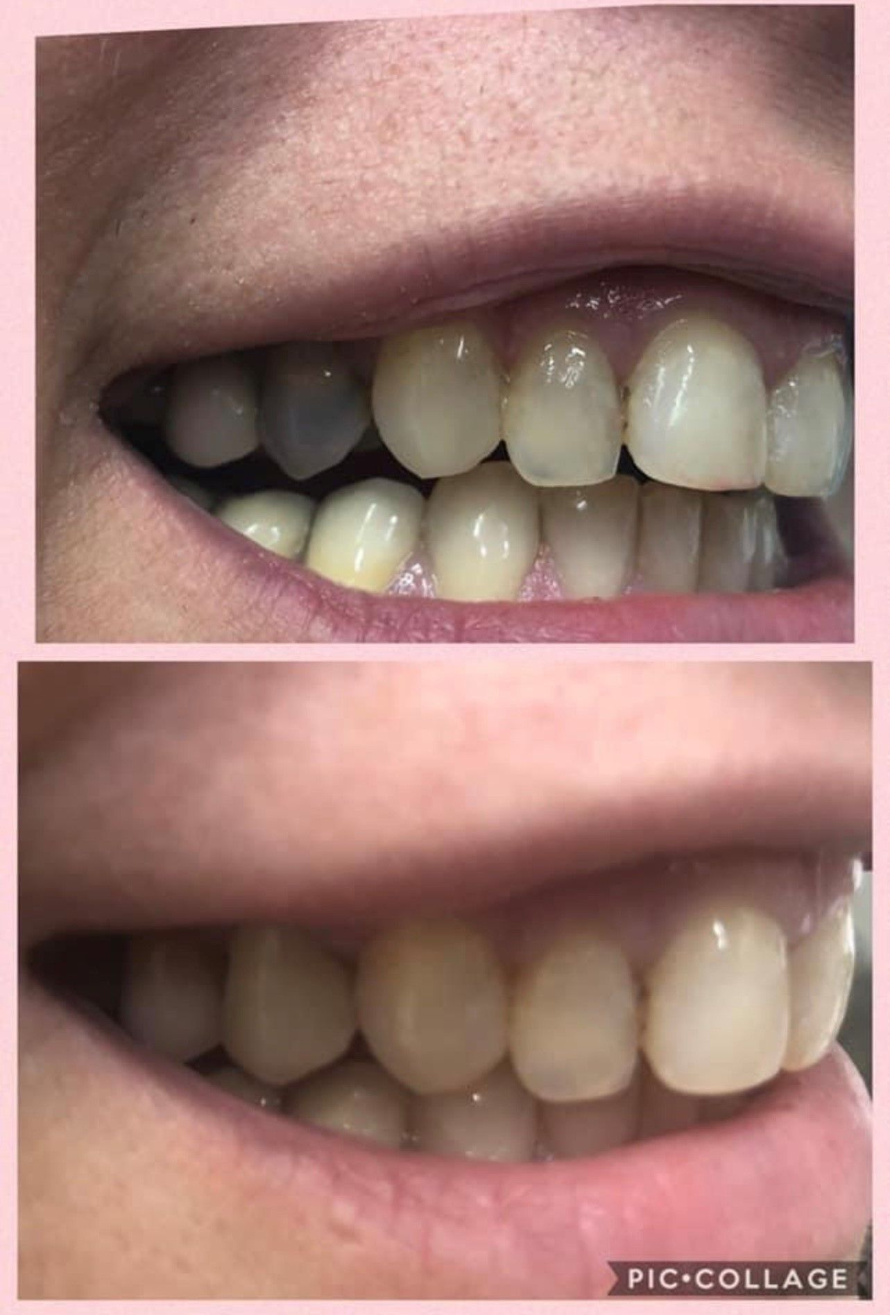 Gallery | Epping, VIC | Dento Mak Dental Surgery