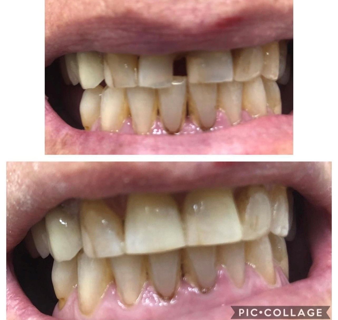 Gallery | Epping, VIC | Dento Mak Dental Surgery