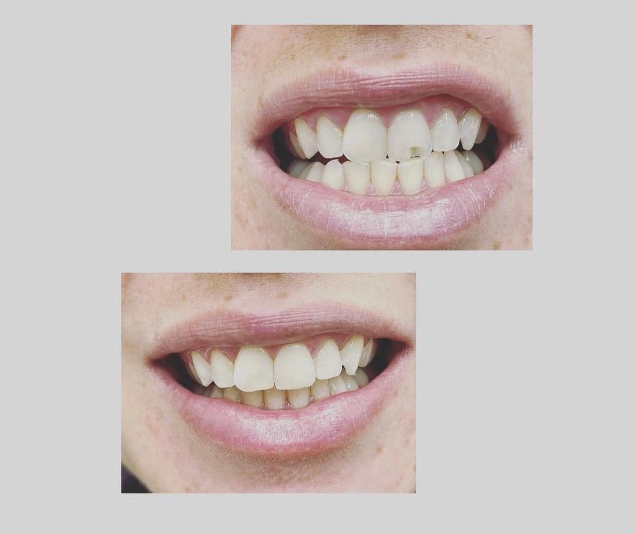 Gallery | Epping, VIC | Dento Mak Dental Surgery