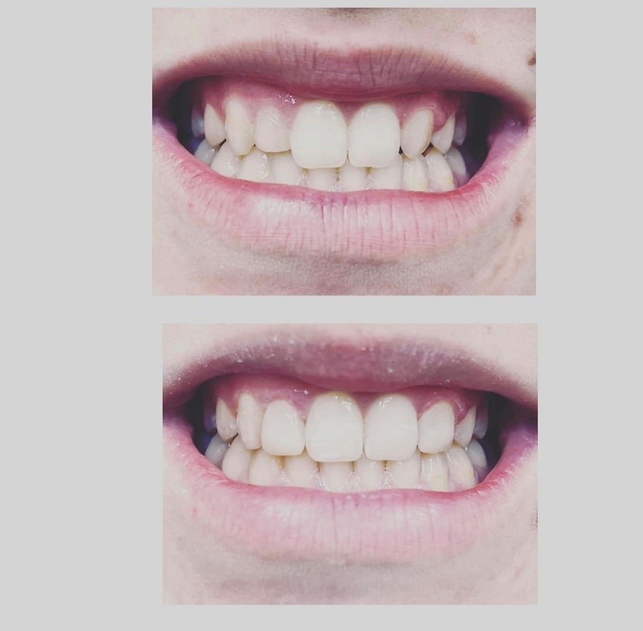 Gallery | Epping, VIC | Dento Mak Dental Surgery