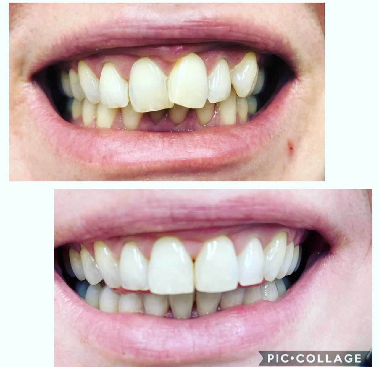 Gallery | Epping, VIC | Dento Mak Dental Surgery